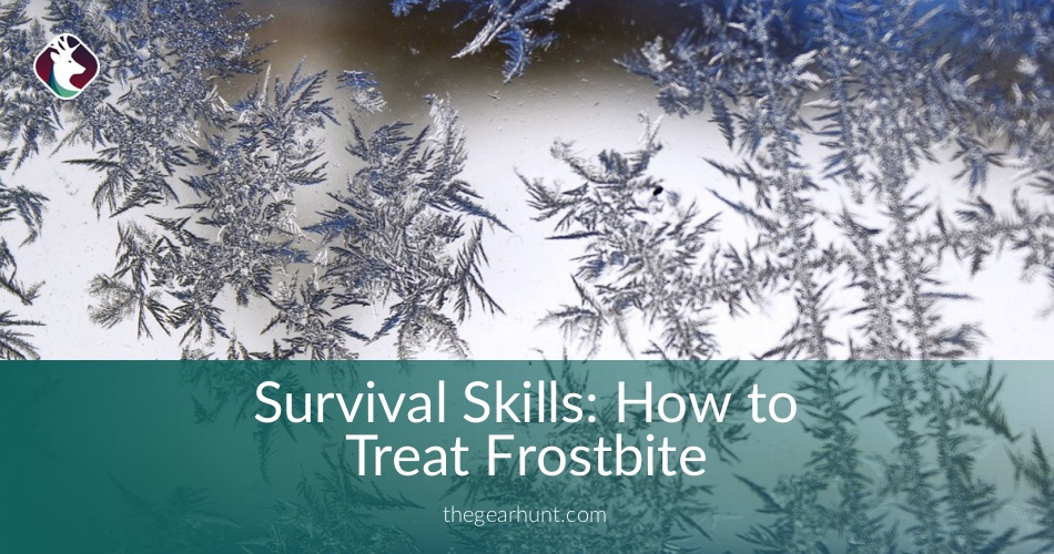 Survival Skills: How to Treat Frostbite - TheGearHunt